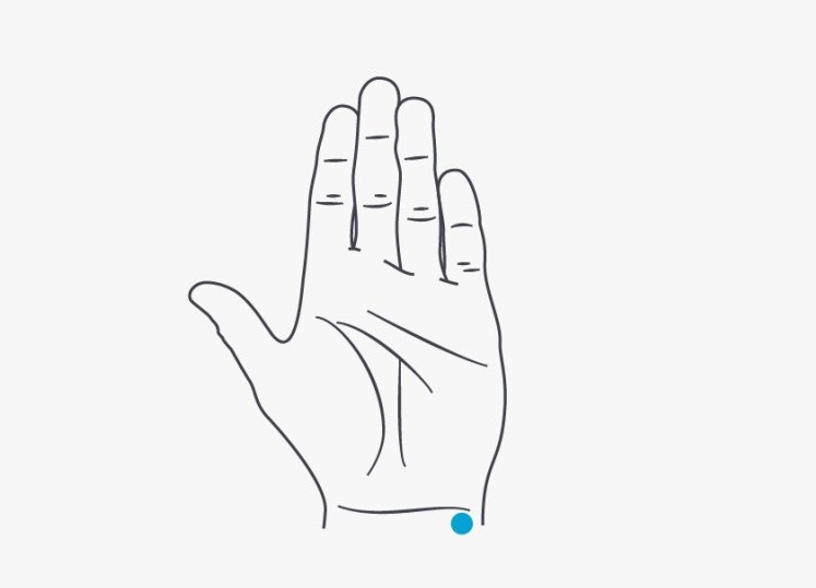 TCM Views on Insomnia